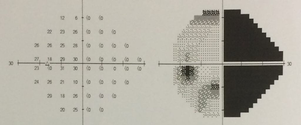 Imaging and Treatment | Capital Eye Specialists